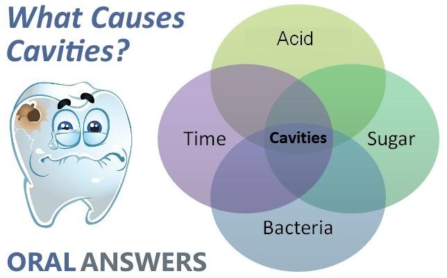 What Makes Someone High Risk for Cavities