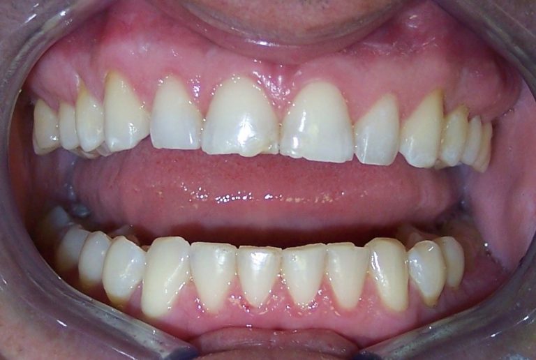 Aging Smiles: What Makes a Smile Look “Old”?