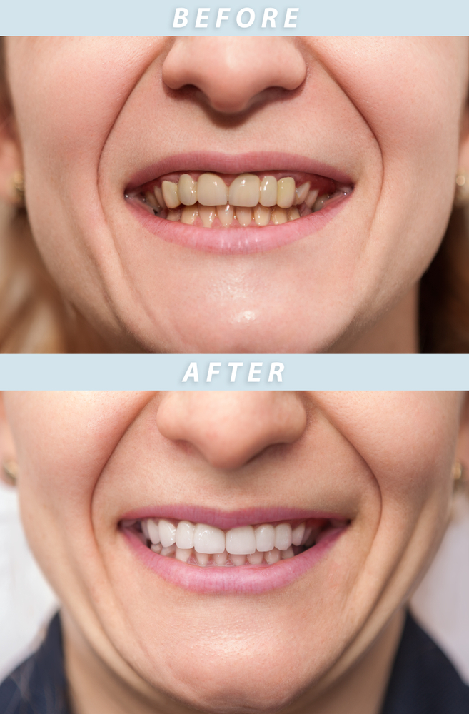 How Can Dental Treatments Make You Look Younger?